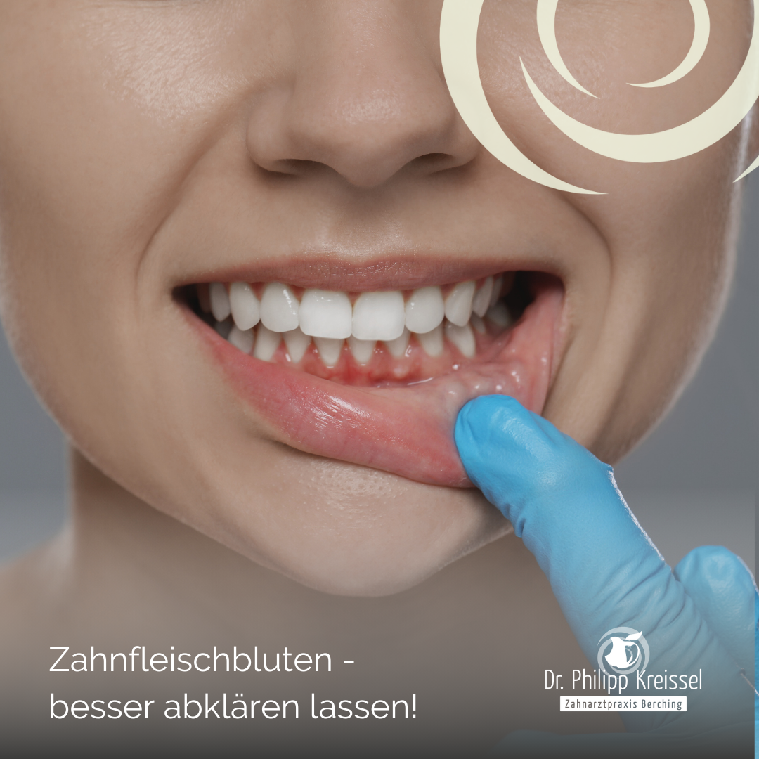 Zahnfleischbluten – Wann sollten Sie unsere Praxis in Berching aufsuchen?